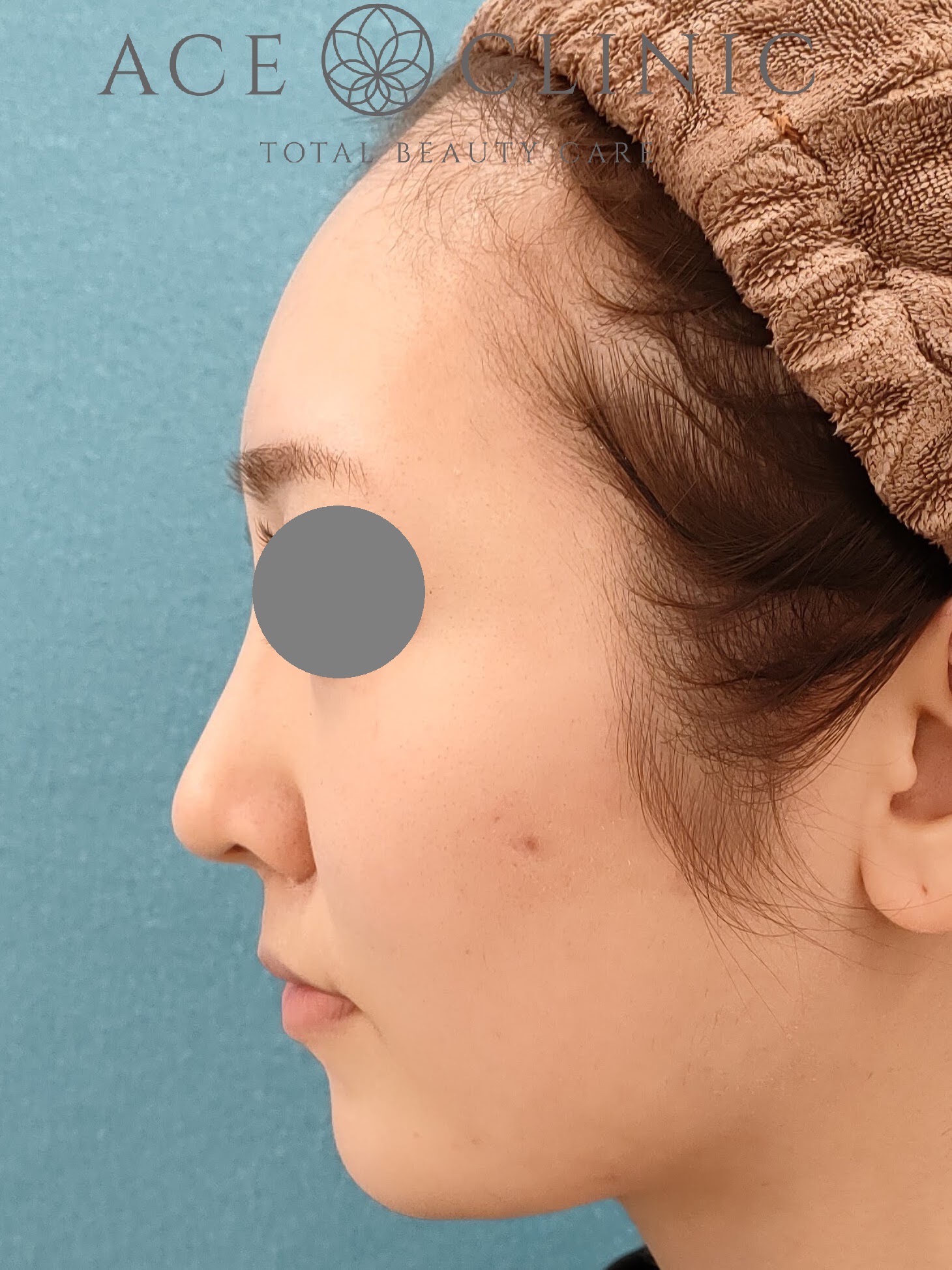 症例紹介 | 医療法人一美会エースクリニック